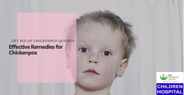 Chickenpox in Children: Causes, Symptoms, and Relief – The Pediatric Center